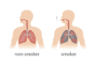 Smoke Lungs vs. Healthy Lungs | Dr. George Karimundackal